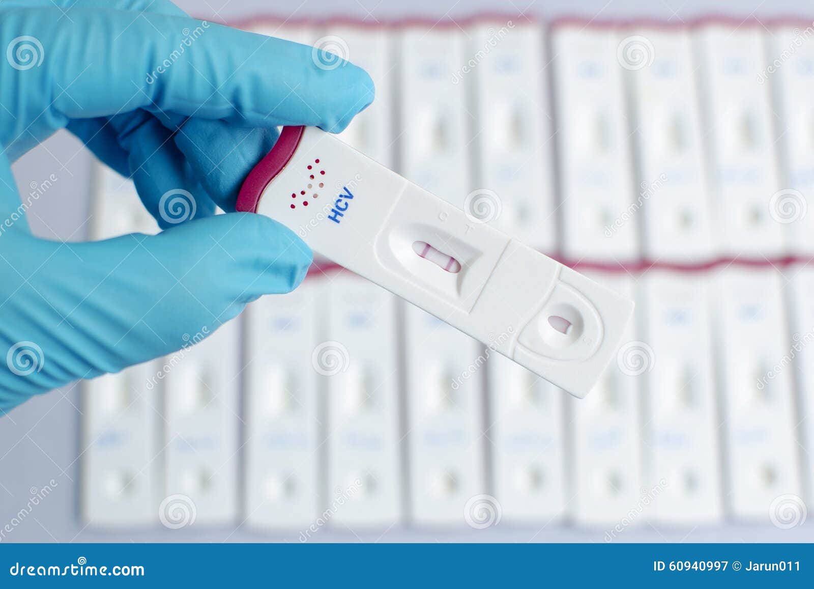 Hepatitis C Virus (HCV) Positive Stock Image - Image of hepatitis ...