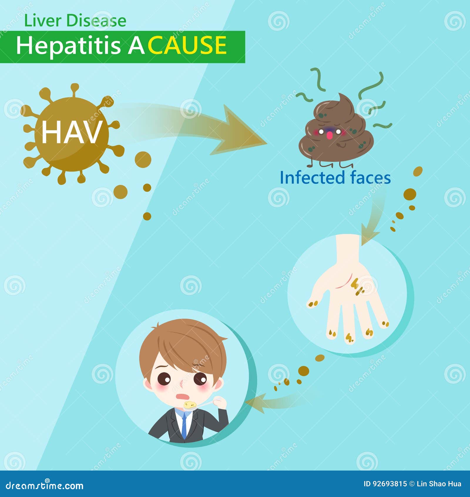 Hepatitis a cause stock vector. Illustration of blood - 92693815 Hepatitis a cause stock vector. Illustration of blood - 92693815