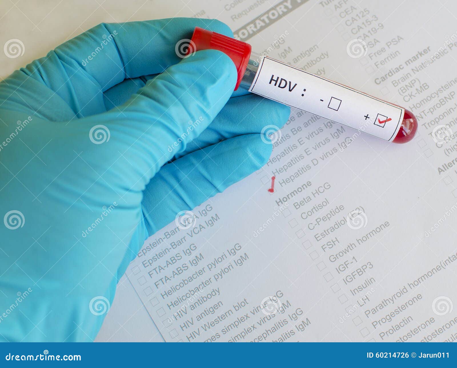Hepatitis D virus (HDV) stock photo. Image of microbiology - 60214726