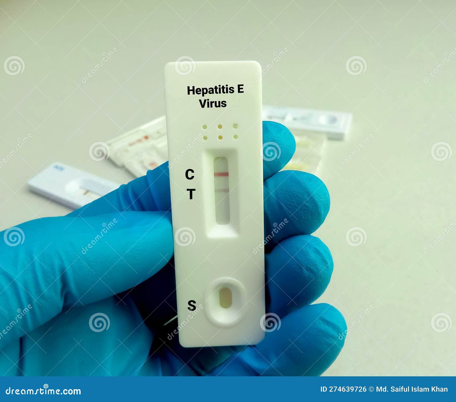 Hepatitis E Virus Rapid Screening Test Stock Photo - Image of holding ...