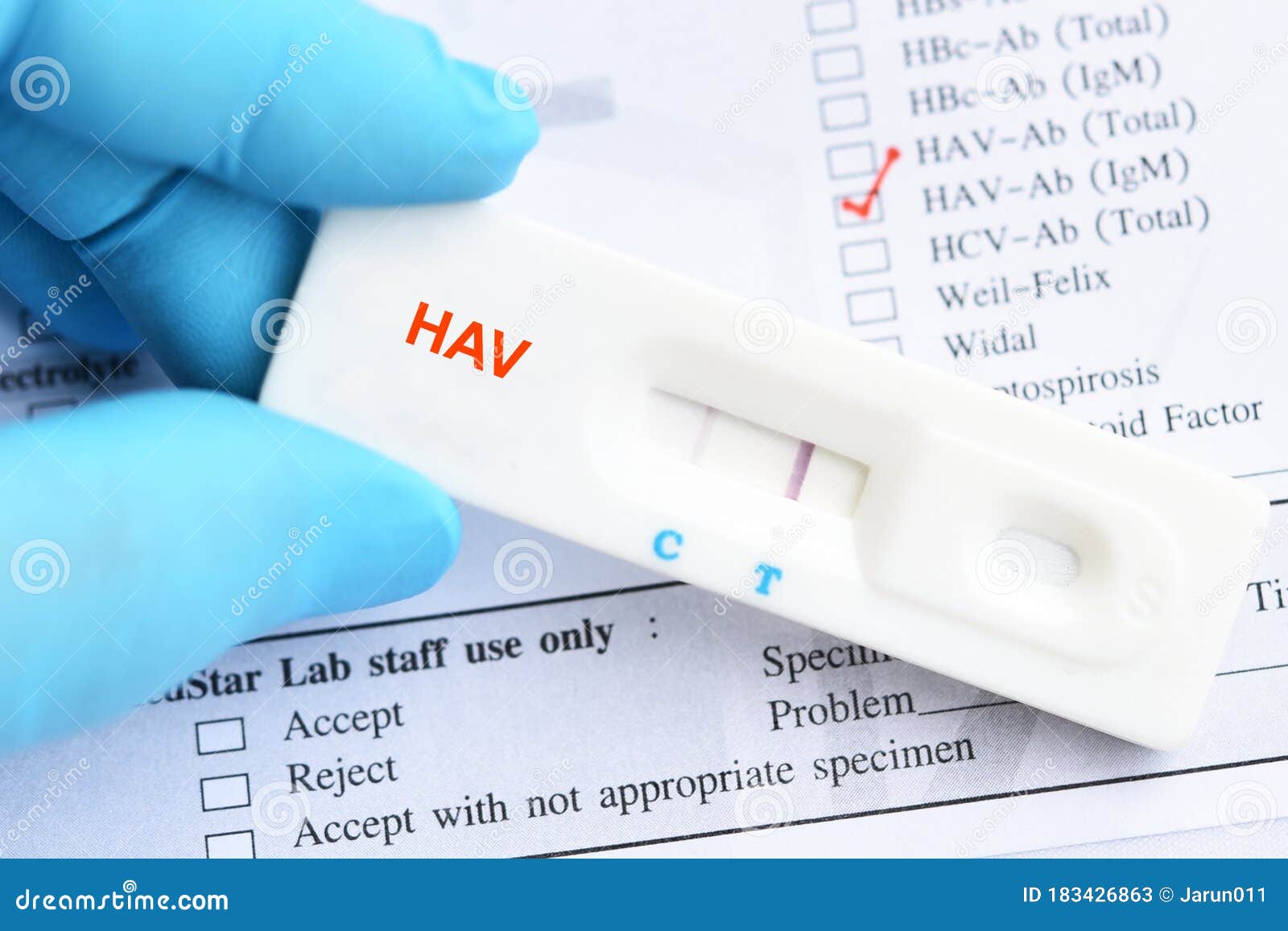 Hepatitis a Virus Positive Test Result Stock Image - Image of checkup ...