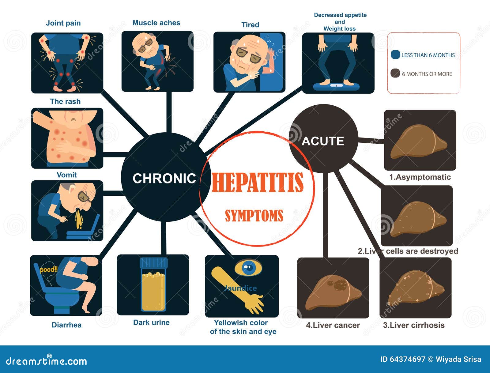 Hepatitissymptome vektor abbildung. Illustration von akut - 64374697