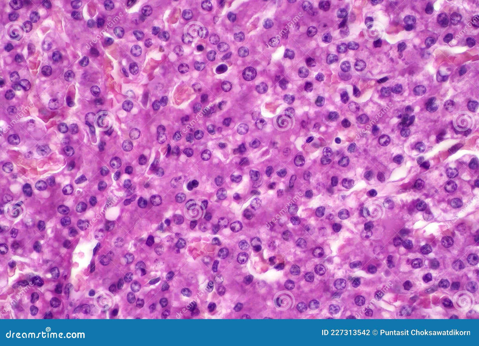 Hepatocyte Is Cell Of The Main Parenchymal Tissue Of The Liver Under ...