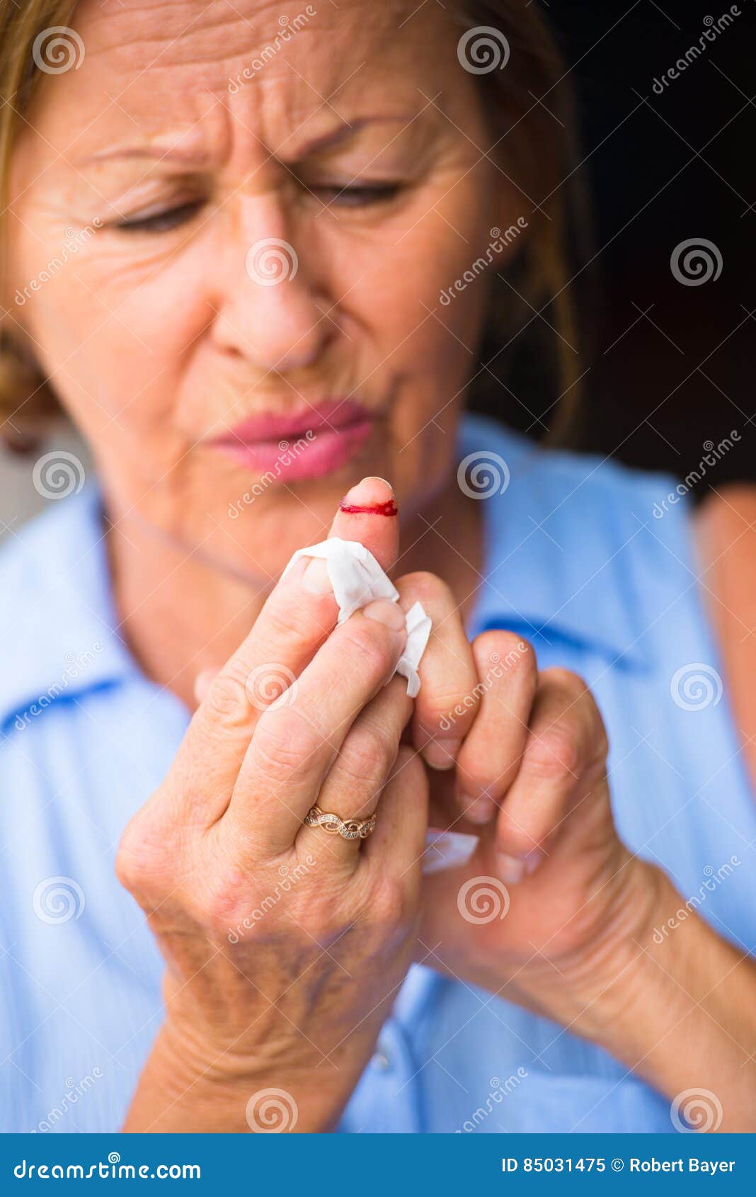 Herida Sangrienta Dolorosa Subrayada Del Finger De La Mujer Imagen de ...