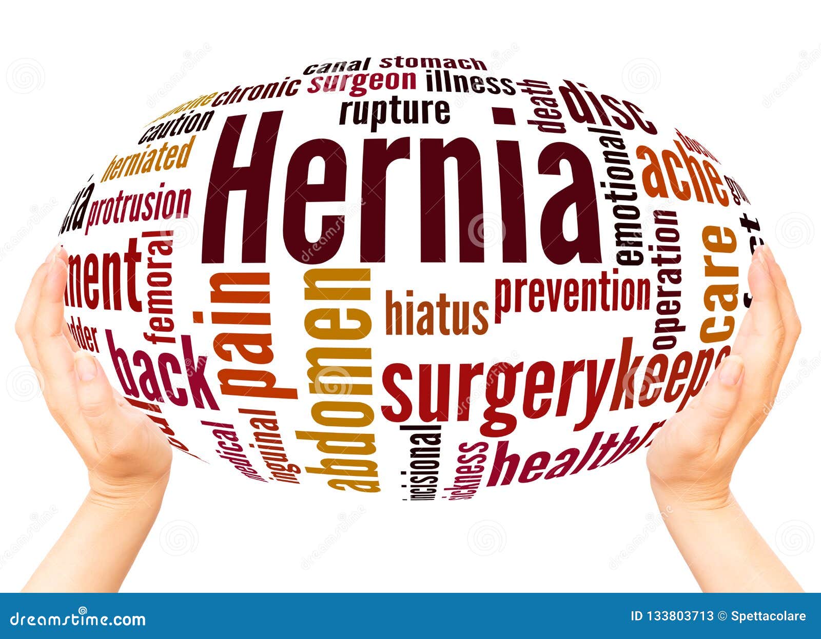 Hernia Word Cloud Hand Sphere Concept Stock Illustration - Illustration ... Hernia Word Cloud Hand Sphere Concept Stock Illustration - Illustration ...