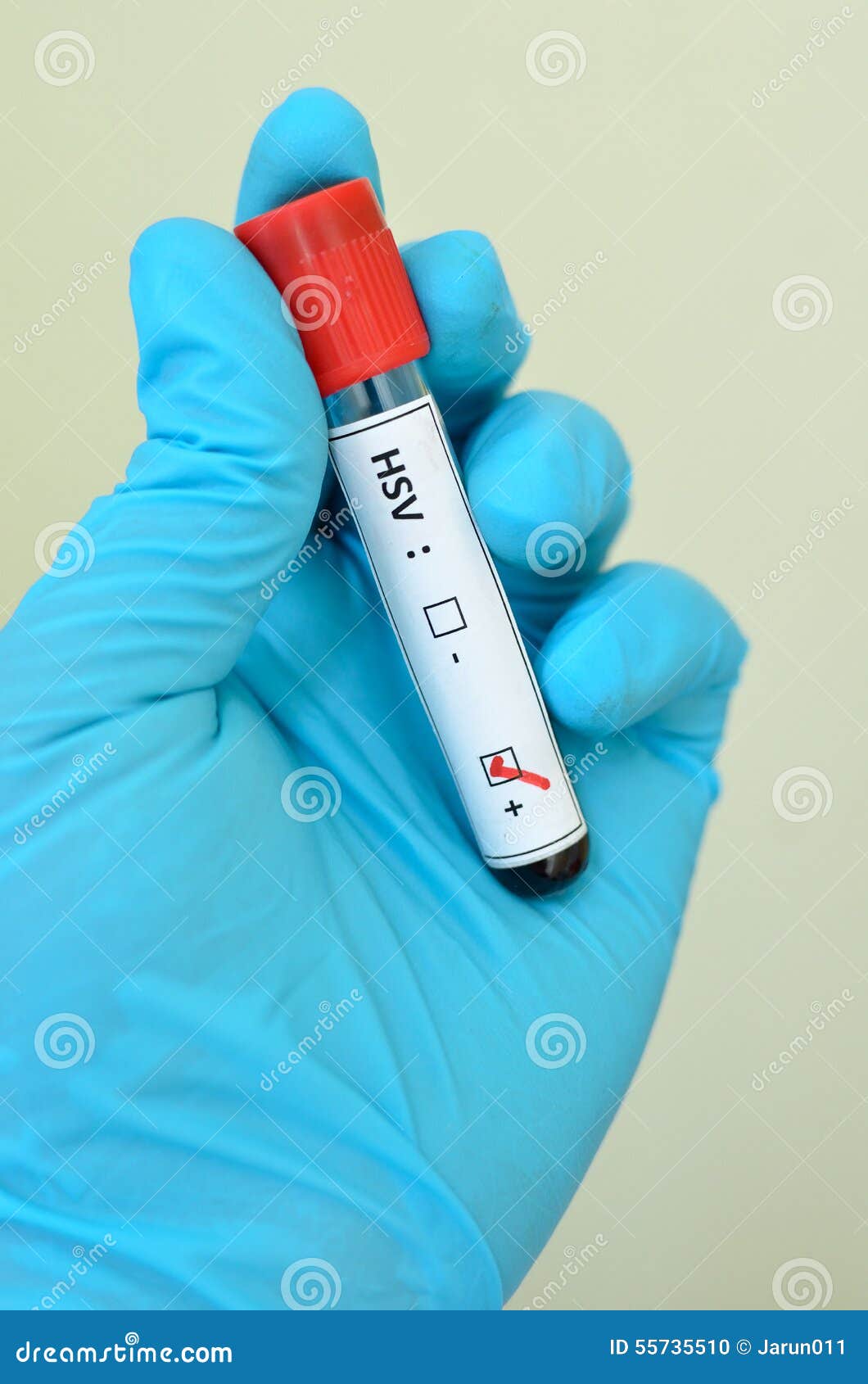 Herpes positive stock photo. Image of biology, laboratory - 55735510