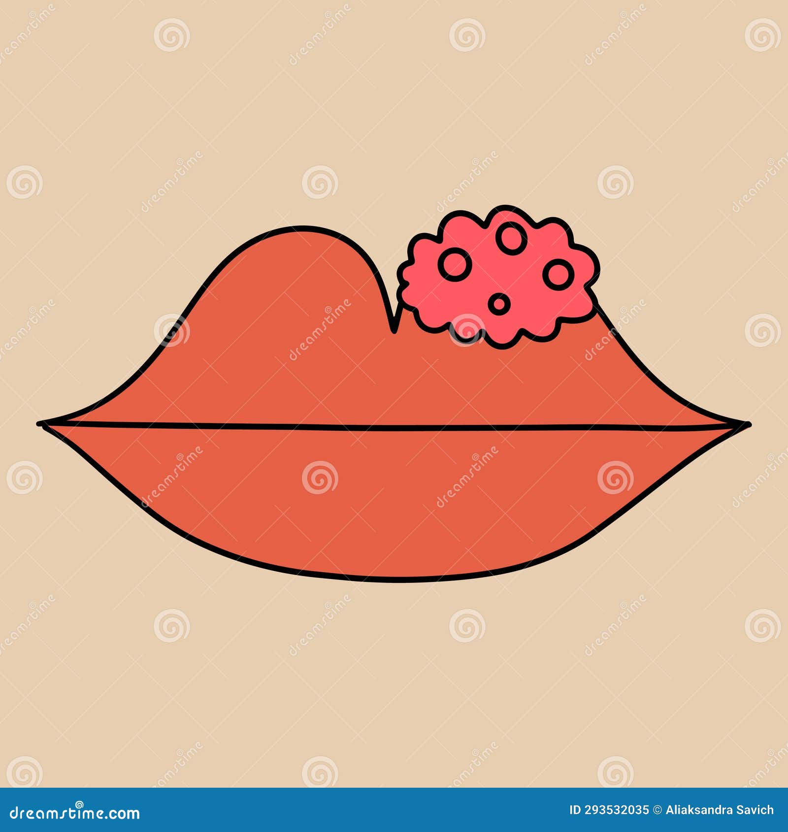 Herpes Vector. Cartoon. Isolated Art On White Background. Flat ...