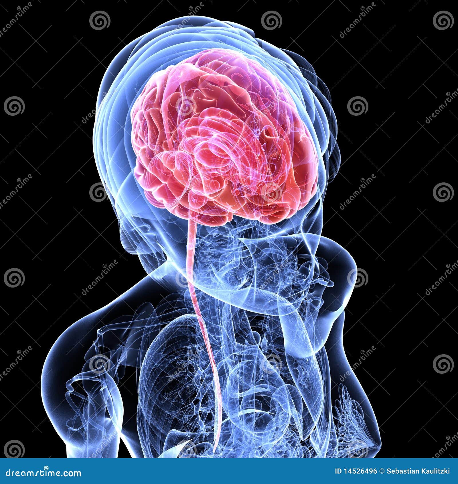 Hersen tumor stock illustratie. Illustration of kennis - 14526496