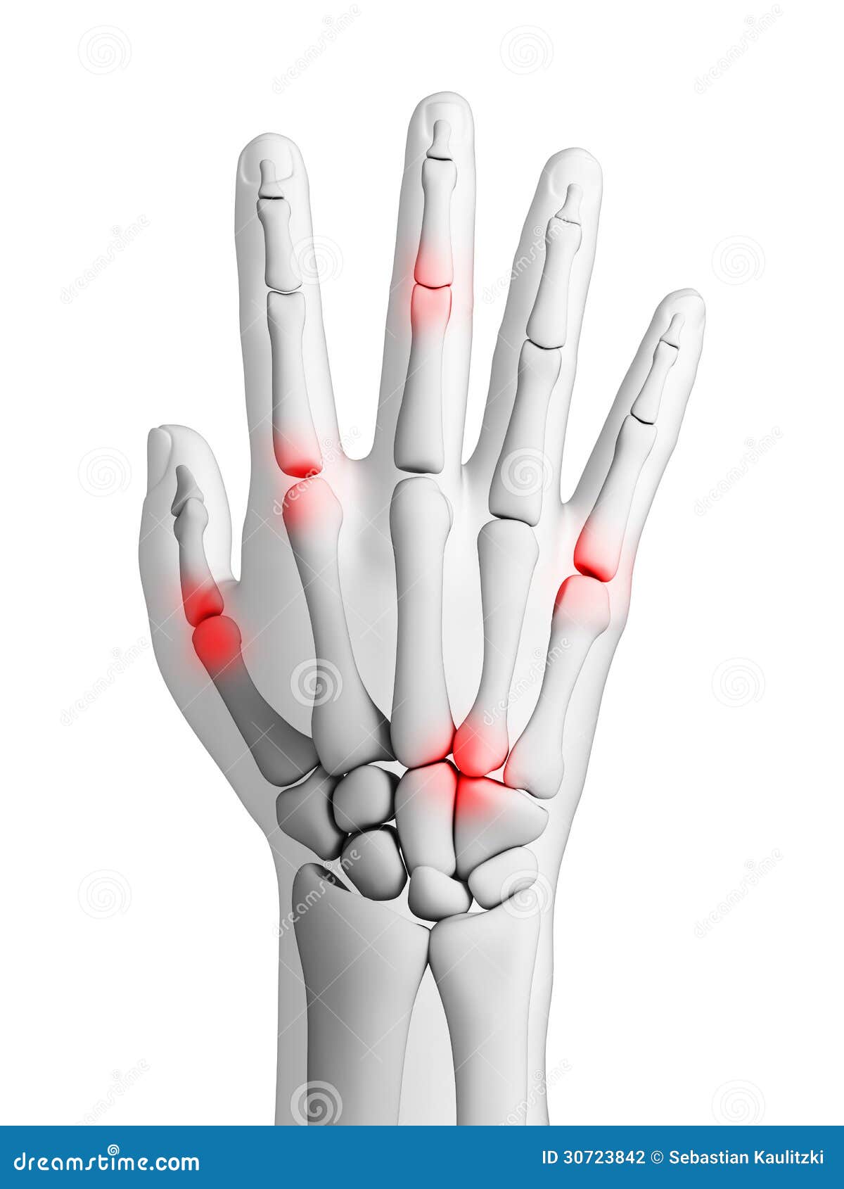 Hervorgehobene Fingergelenke Stock Abbildung - Illustration von ...