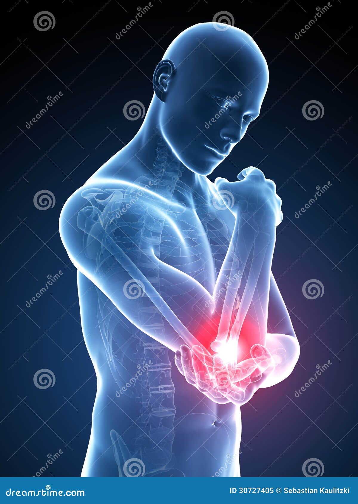 Ellbogen Stock Illustrationen, Vektoren, & Kliparts - 597 Stock ...