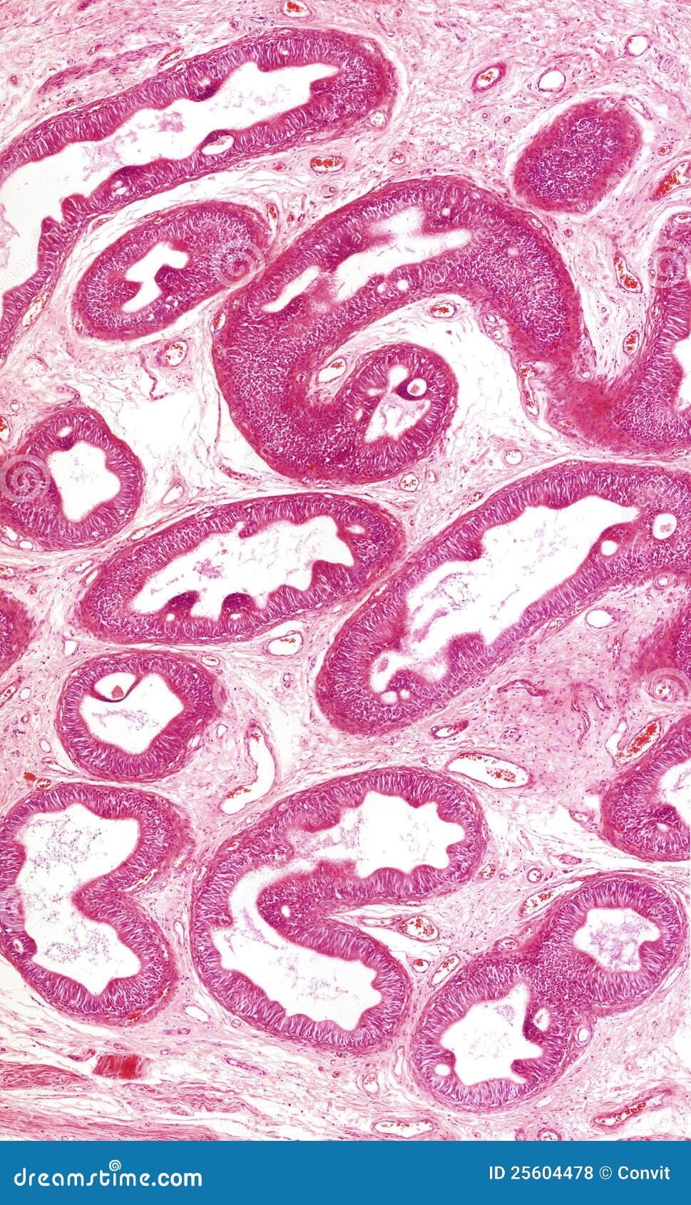 Het Beeld Van De Microscoop Van Menselijke Bijbal Stock Foto - Image of ...