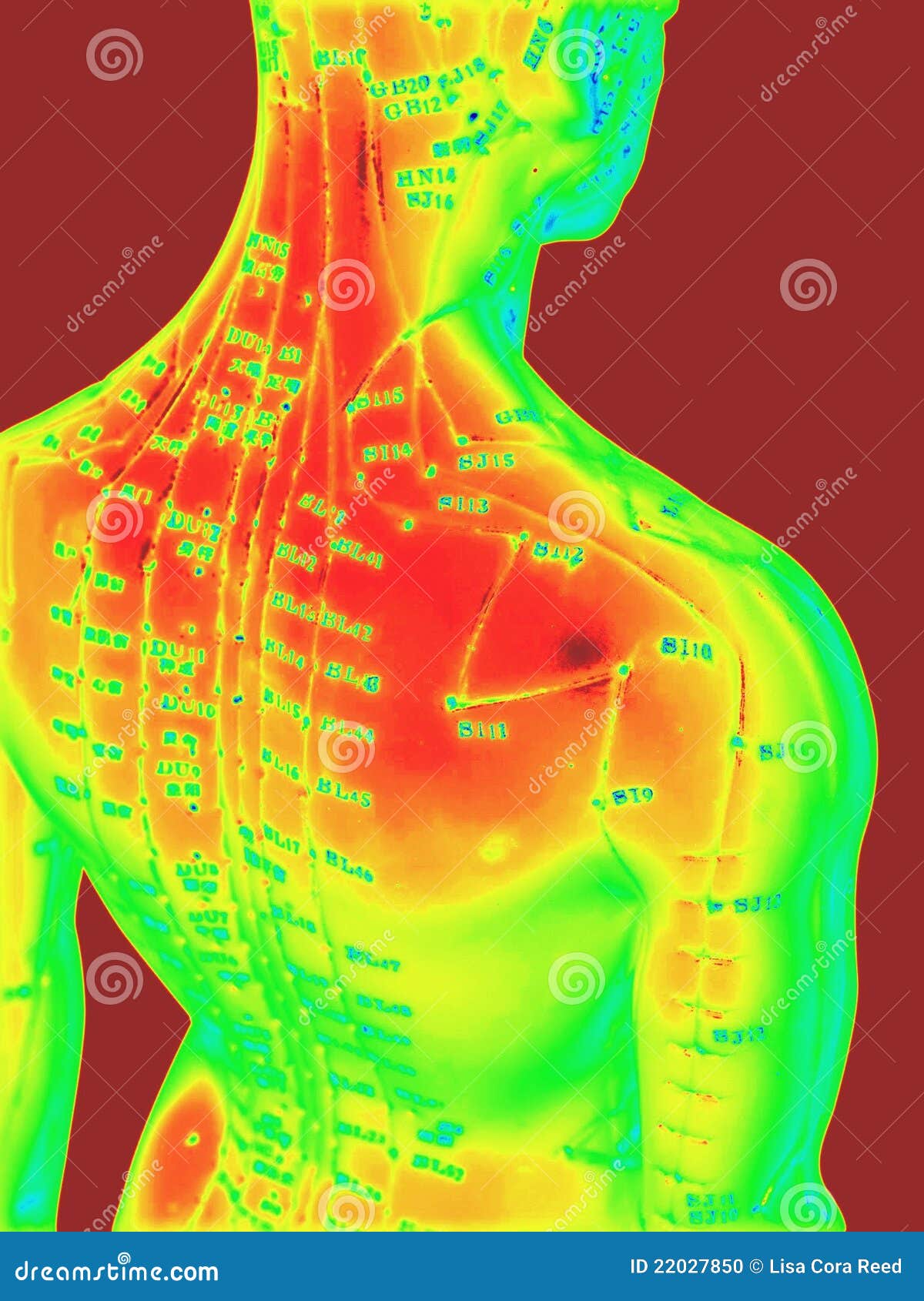 Het Concept Van De Acupunctuur Stock Foto - Image of zijnd, heupjicht ...
