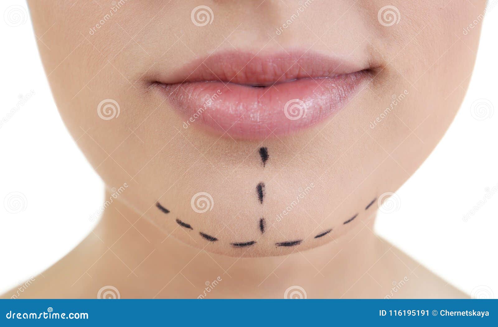 Het Concept Van De Plastische Chirurgie Portret Van Mooie Vrouw Stock ... Het Concept Van De Plastische Chirurgie Portret Van Mooie Vrouw Stock ...
