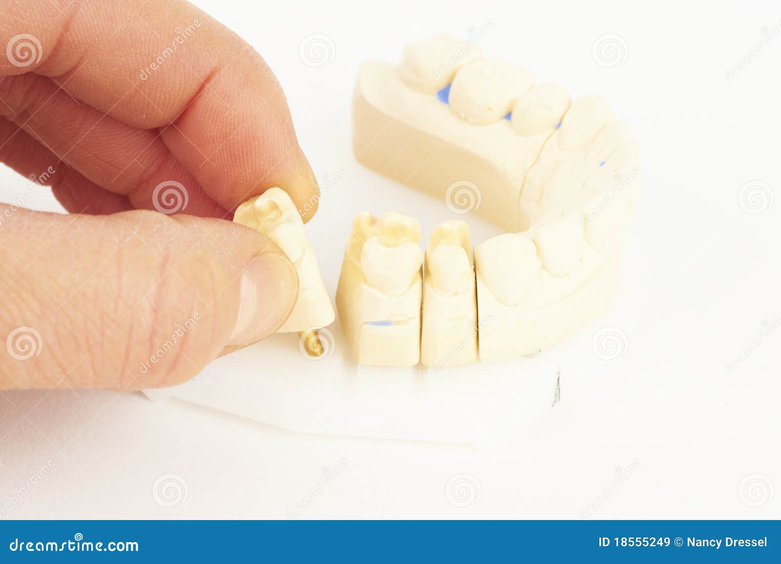 Het Controleren Van Gipsmodel Gebit Stock Afbeelding - Image of gids ...