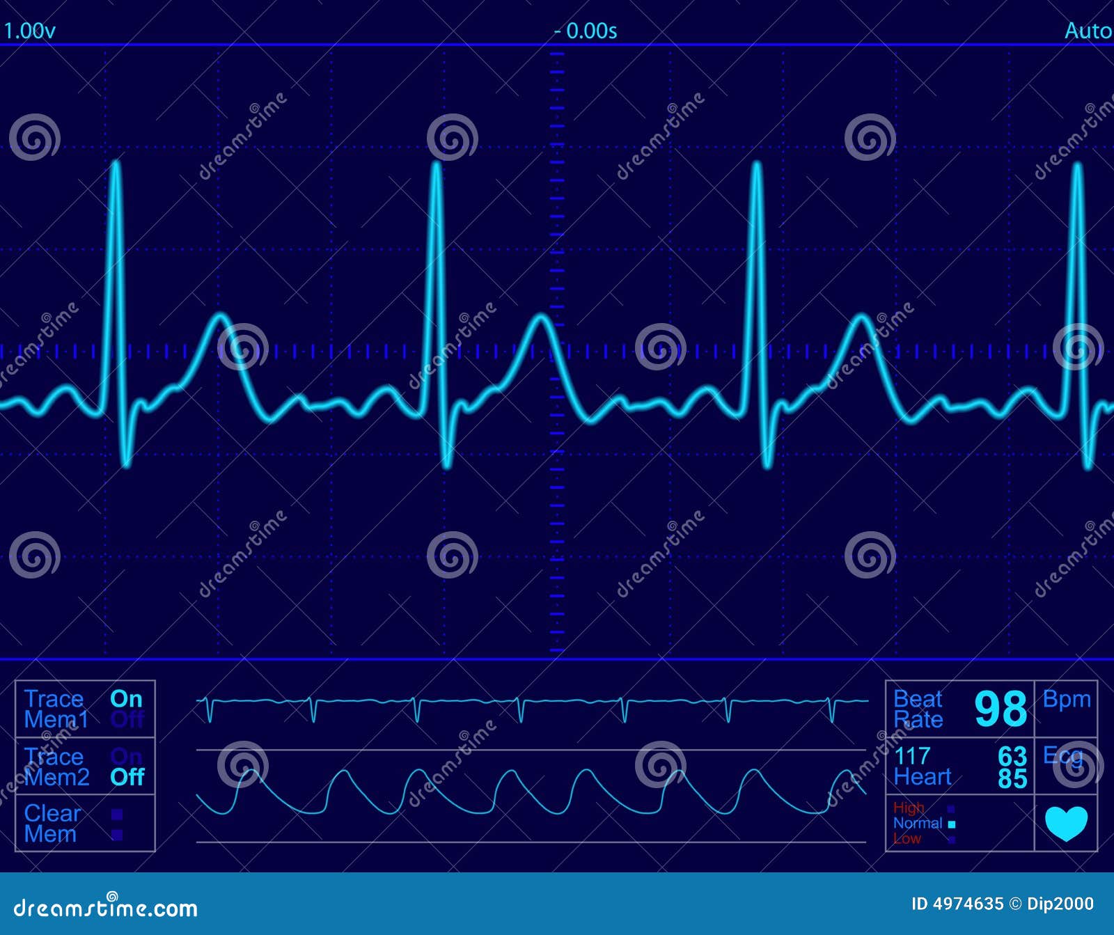 Het De Monitorscherm Van Het Hart Vector Illustratie - Illustration of ...
