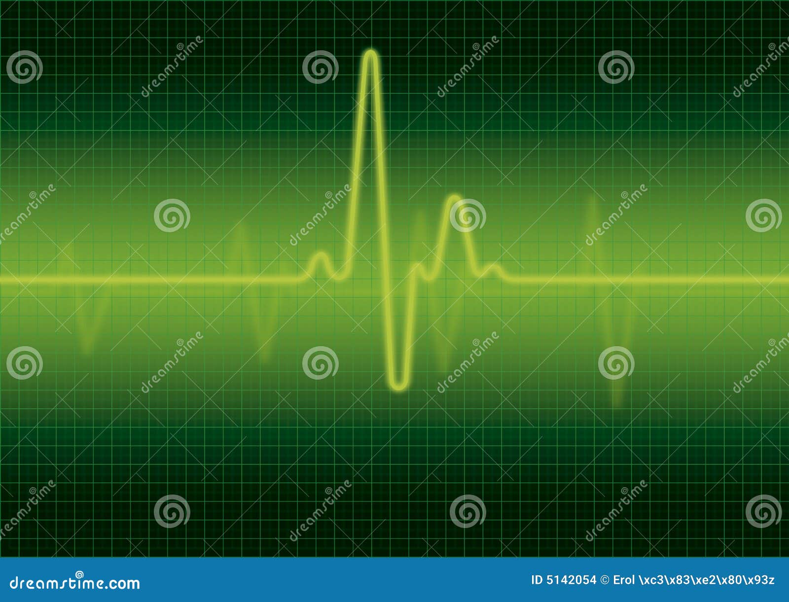 Het De Monitorscherm Van Het Hart Stock Illustratie - Illustration of ...