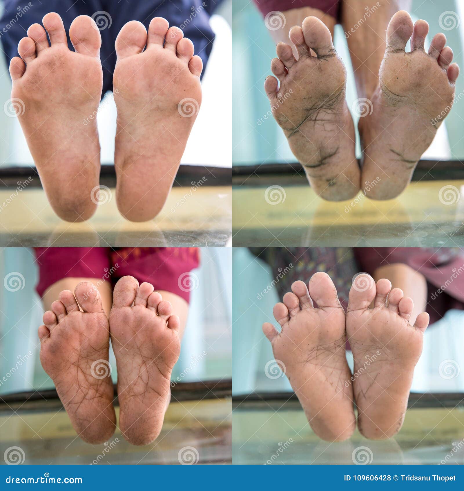 Het diabetesvoet testen stock foto. Image of mens, medisch - 109606428