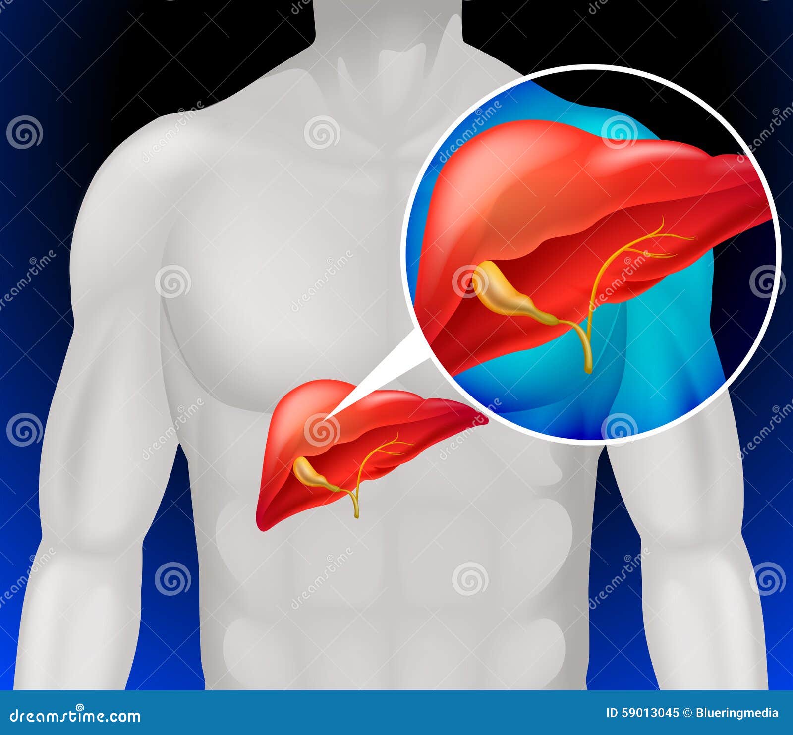 Het Diagram Van Leverkanker in Detail Vector Illustratie - Illustration ...