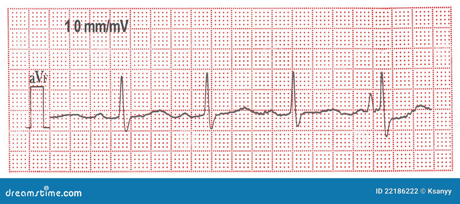 Het elektrocardiogram stock illustratie. Illustration of hart - 22186222