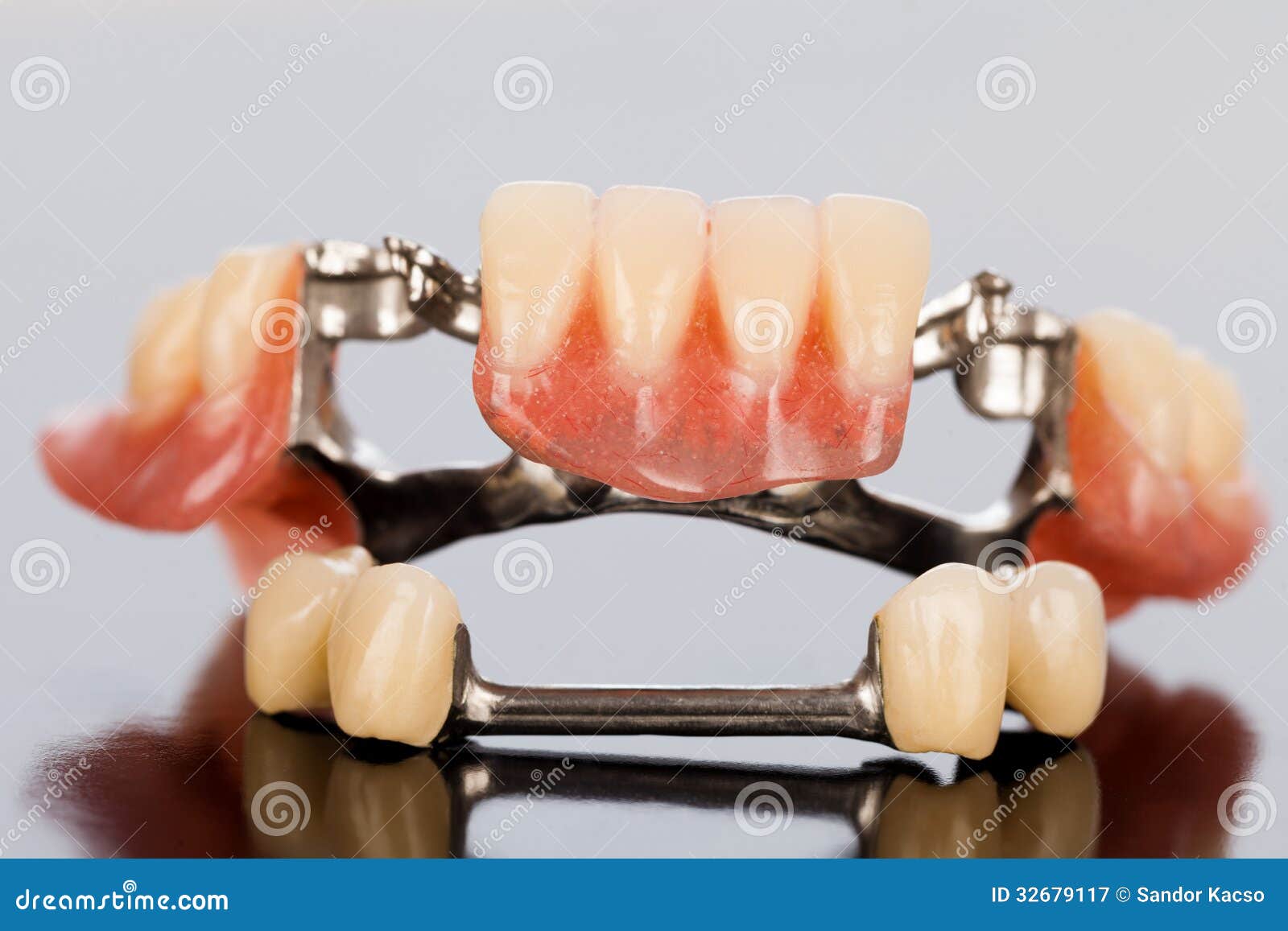 Het Functioneren Van Skeletachtige Prothese Stock Afbeelding - Image of ...