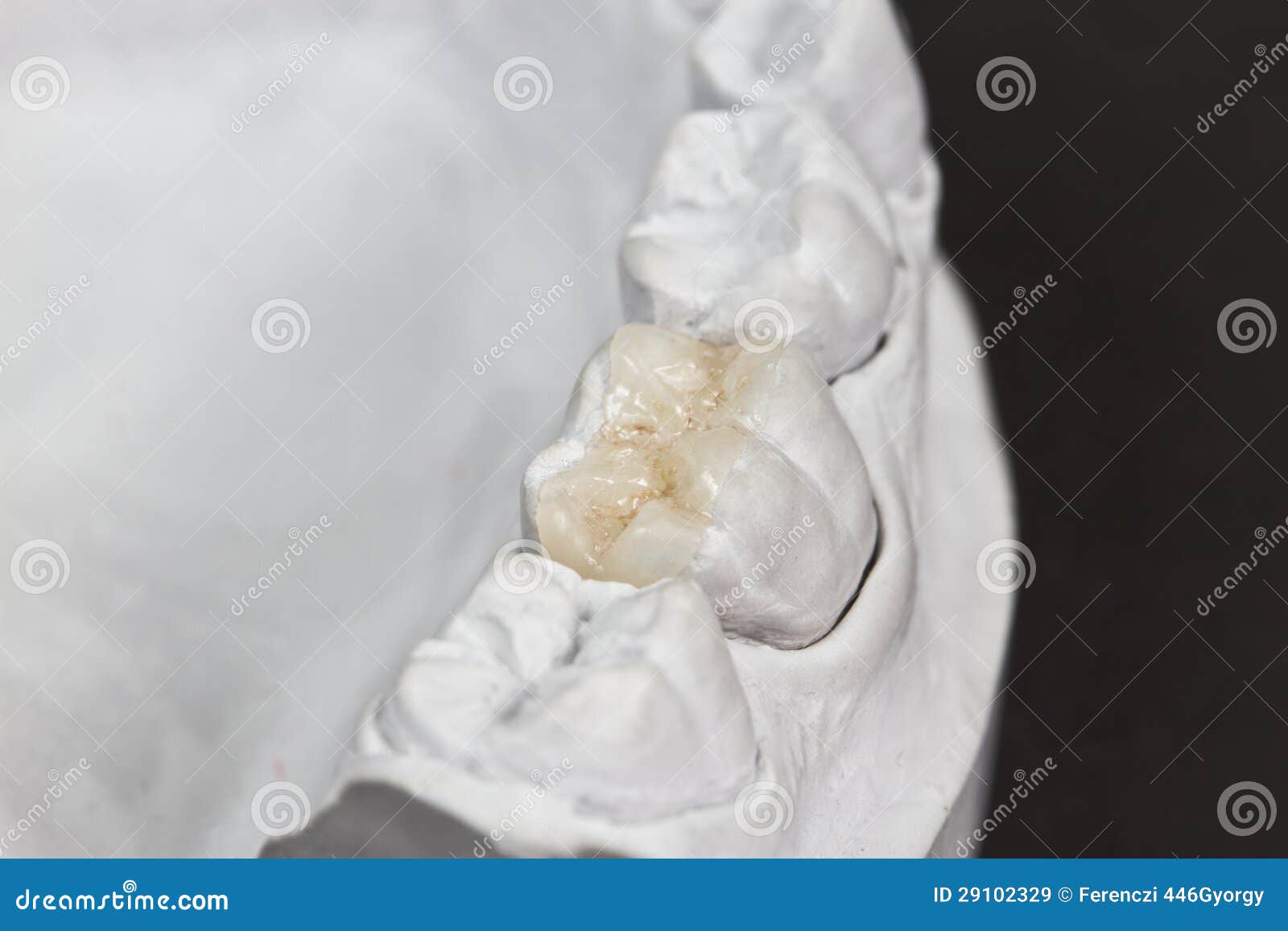 Het gebit van de was stock afbeelding. Image of gips - 29102329