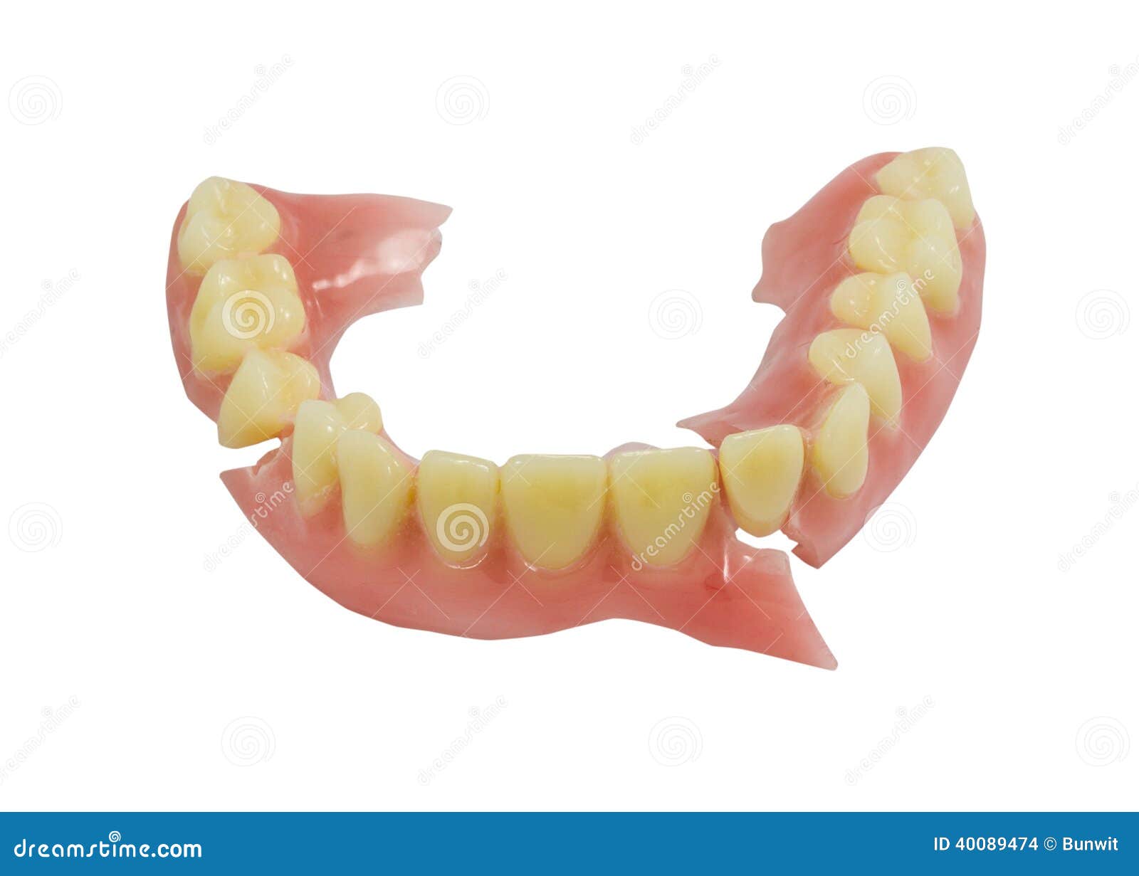 Het Gebroken Gebit Isoleert Op Witte Achtergrond Stock Foto - Image of ...