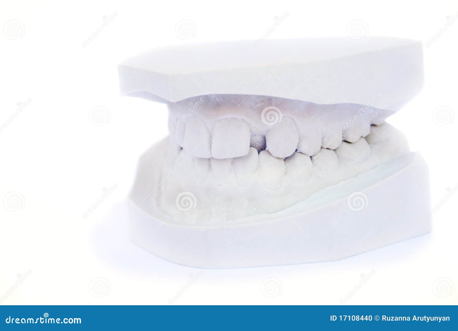 Het gipsmodel van tanden stock foto. Image of werktuigkundige - 17108440
