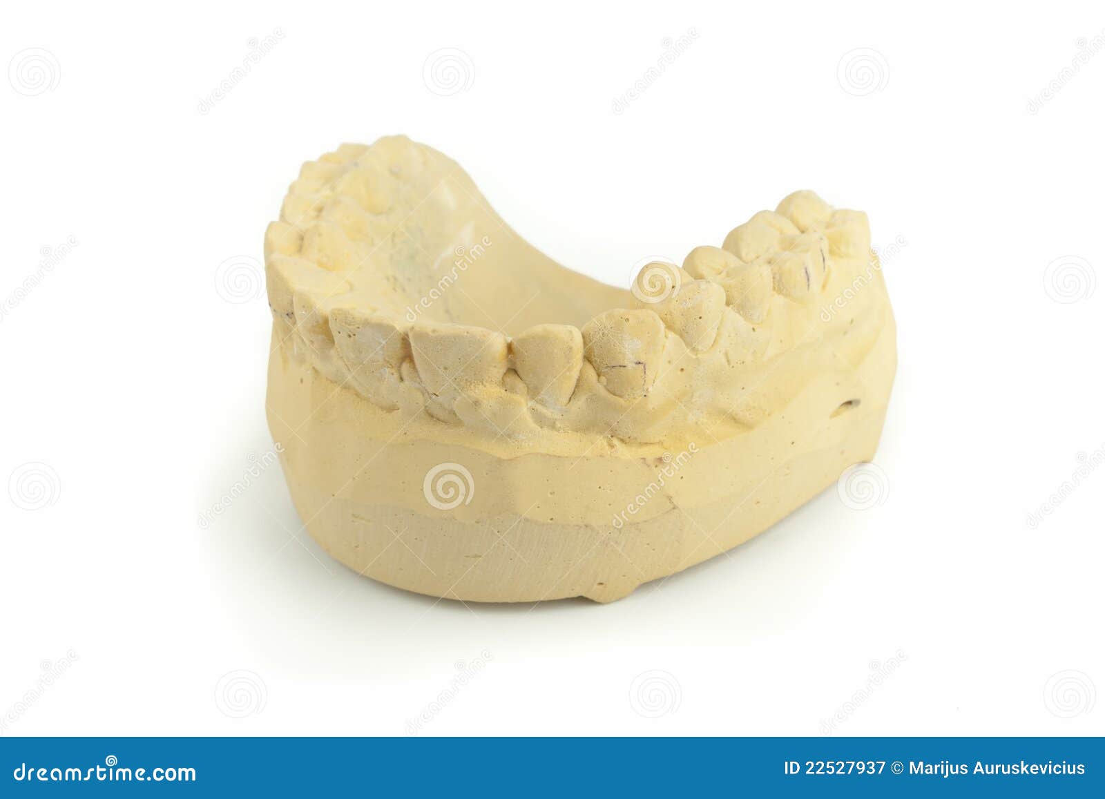 Het gipsmodel van tanden stock afbeelding. Image of steunen - 22527937