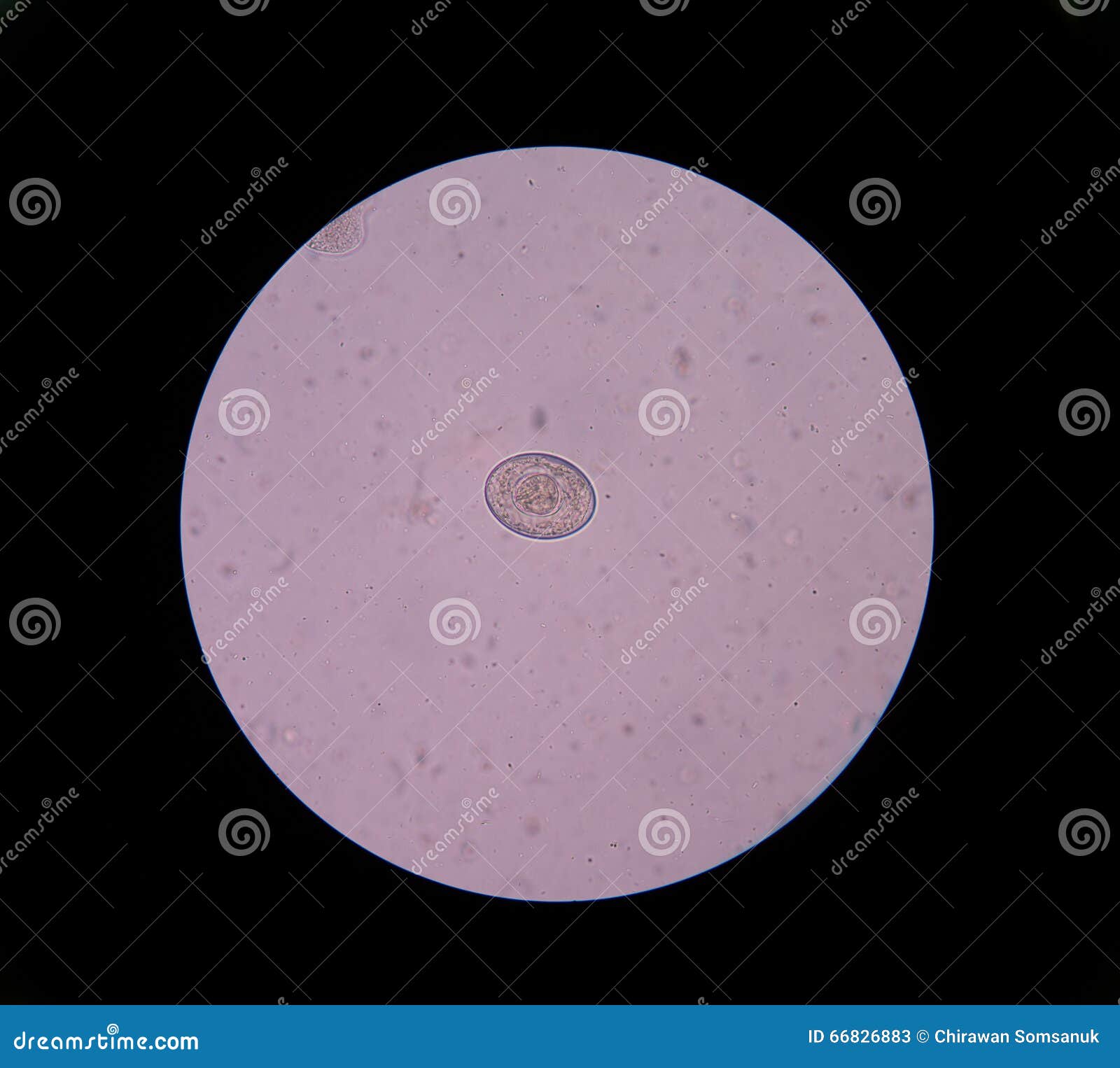 Het Lint is Een Soort Lintworm (een Type Van Worm) Stock Afbeelding ...