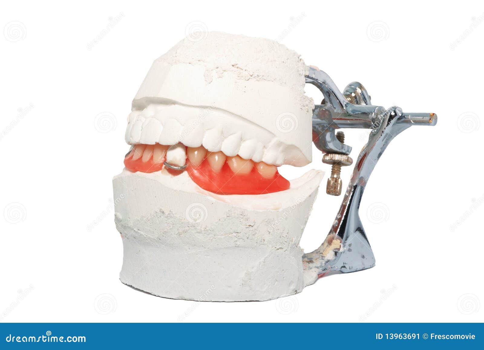 Het Tand Gewricht Van Het Laboratorium Met Tandprothese Stock ...