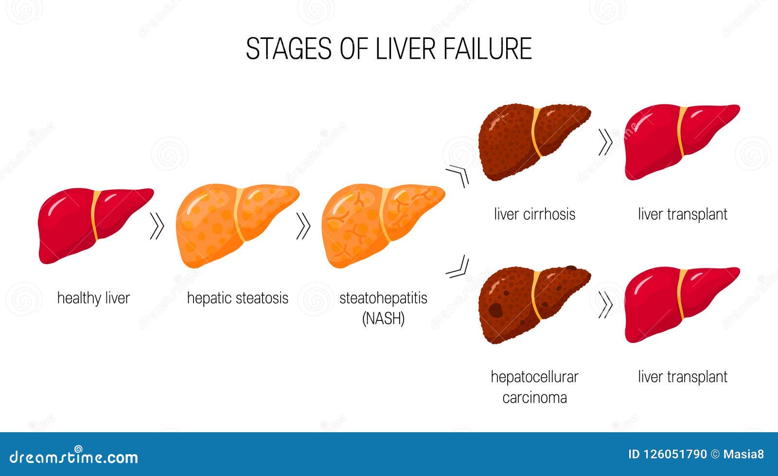 Het Vectorconcept Van De Leverschade Stock Illustratie - Illustration ...
