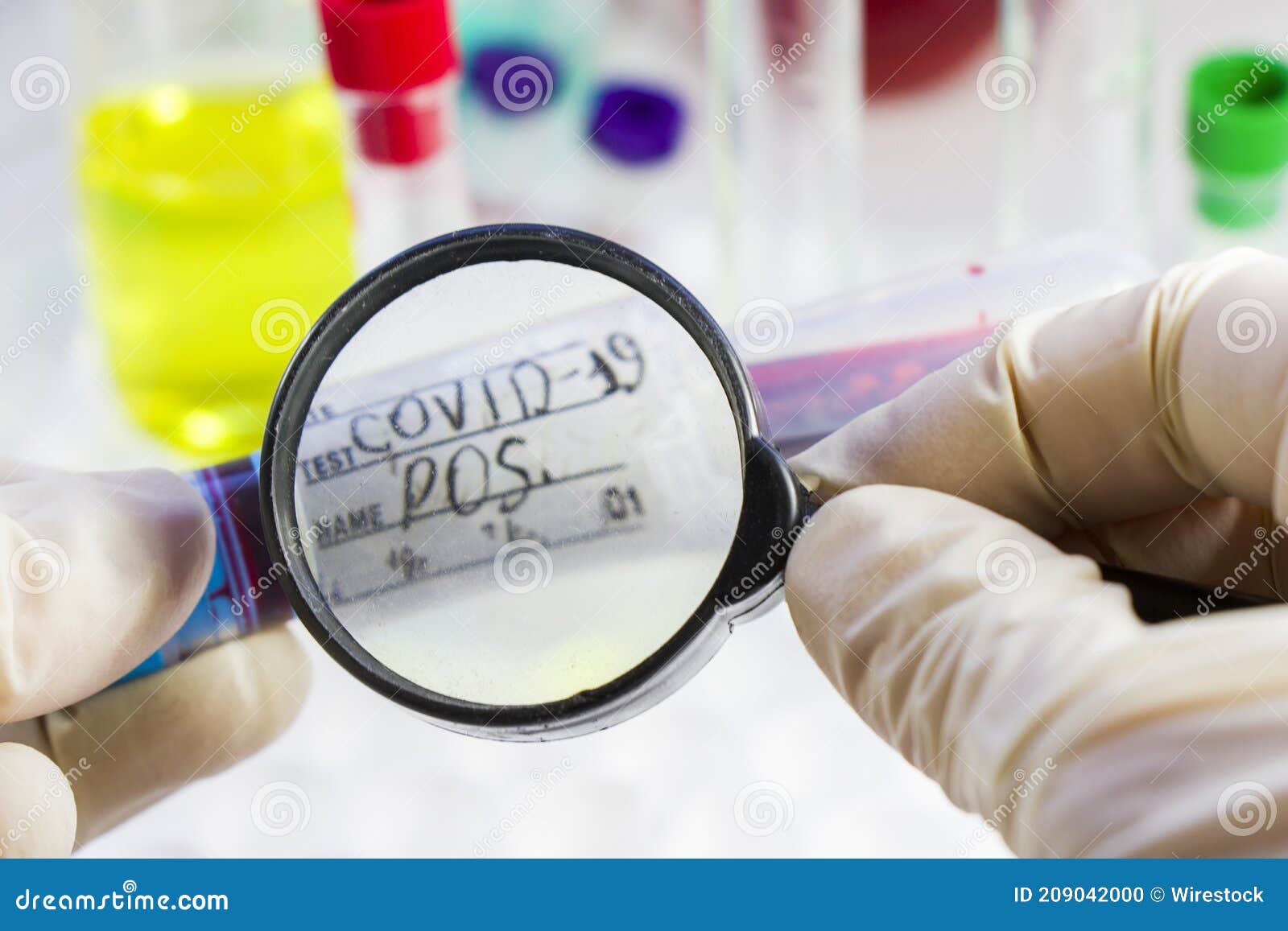 High Angle Shot of a Blood Sample Test with Positive Result Zoomed with ...