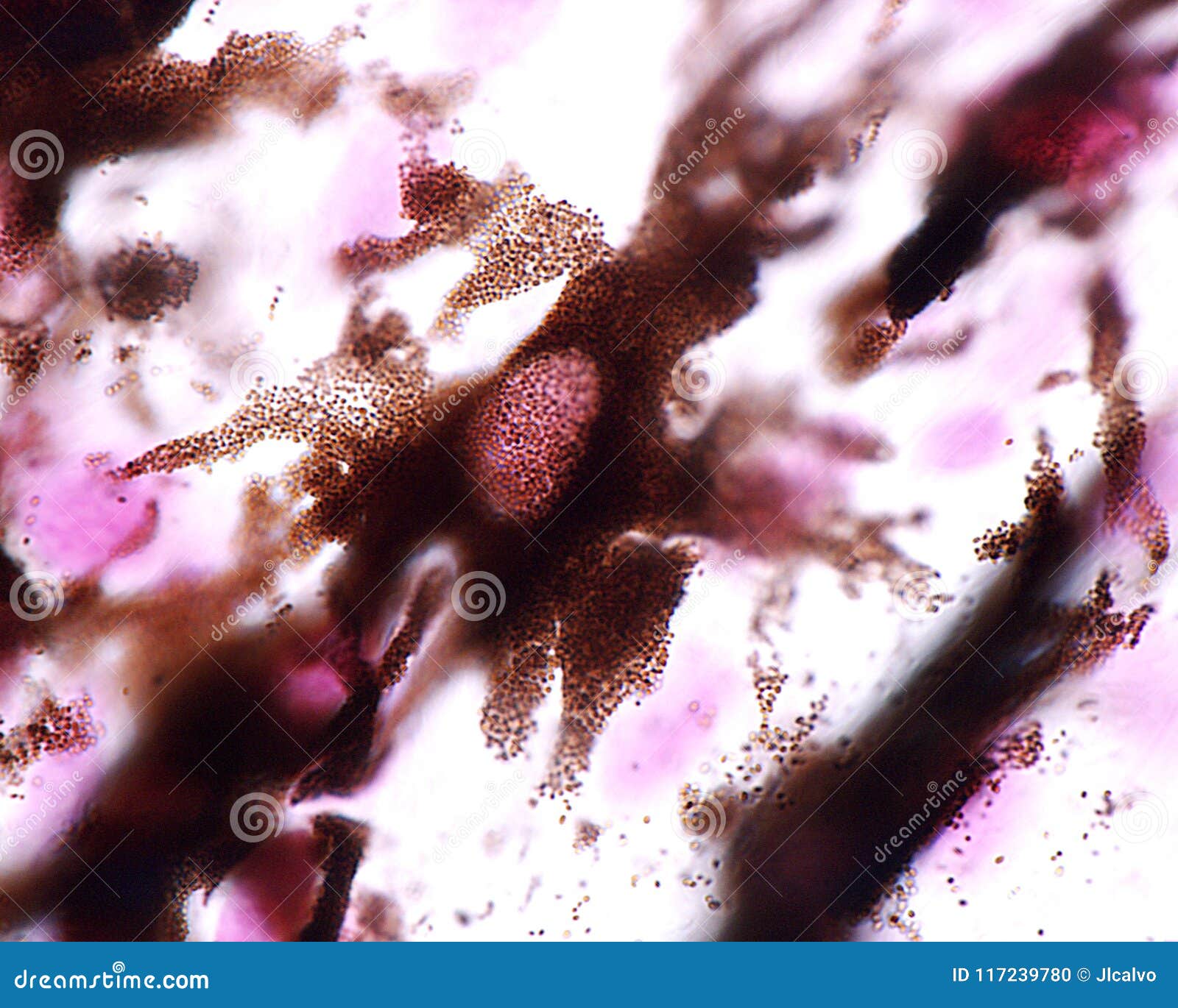 Pigment cell stock photo. Image of microscope, histology - 117239780