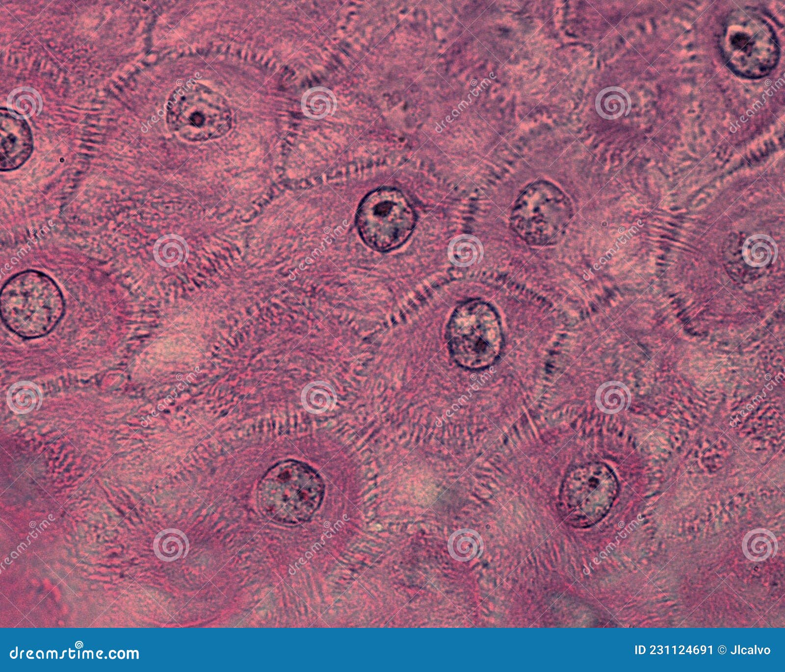 Epidermis. Spinous Cell Layer Stock Image - Image of histology ...