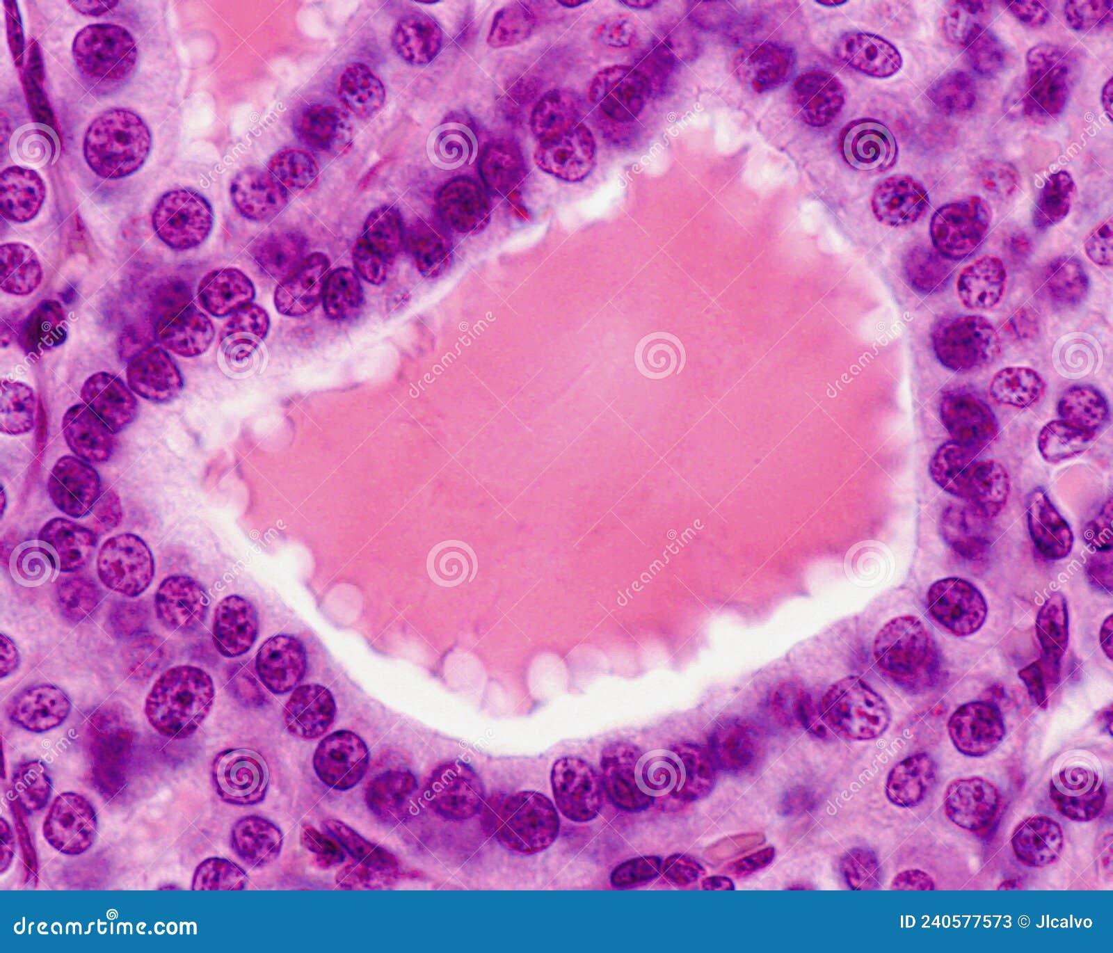 Follicle And Egg Cell In Human Ovary Under Microscope Stock Photo ...