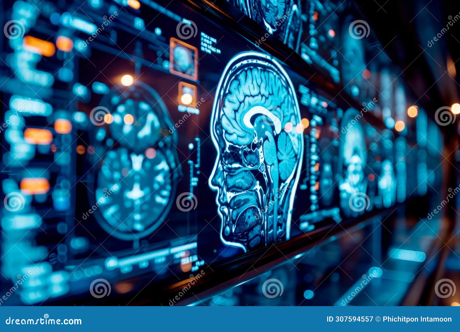 High-resolution Medical Brain Scan Display for Advanced Diagnostics.ai ...