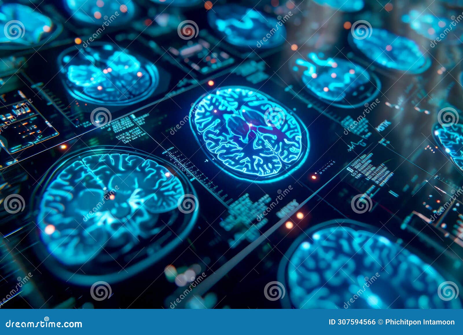 High-resolution Medical Brain Scan Display for Advanced Diagnostics.ai ...