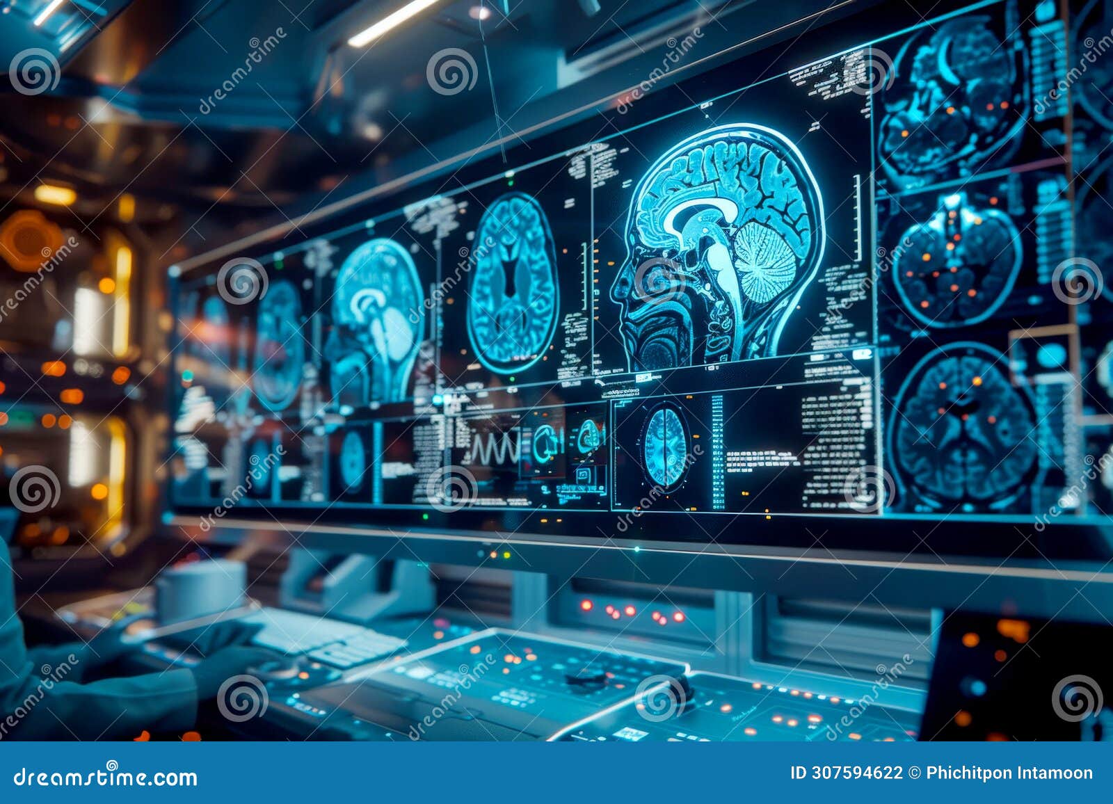 High-resolution Medical Brain Scan Display for Advanced Diagnostics.ai ...