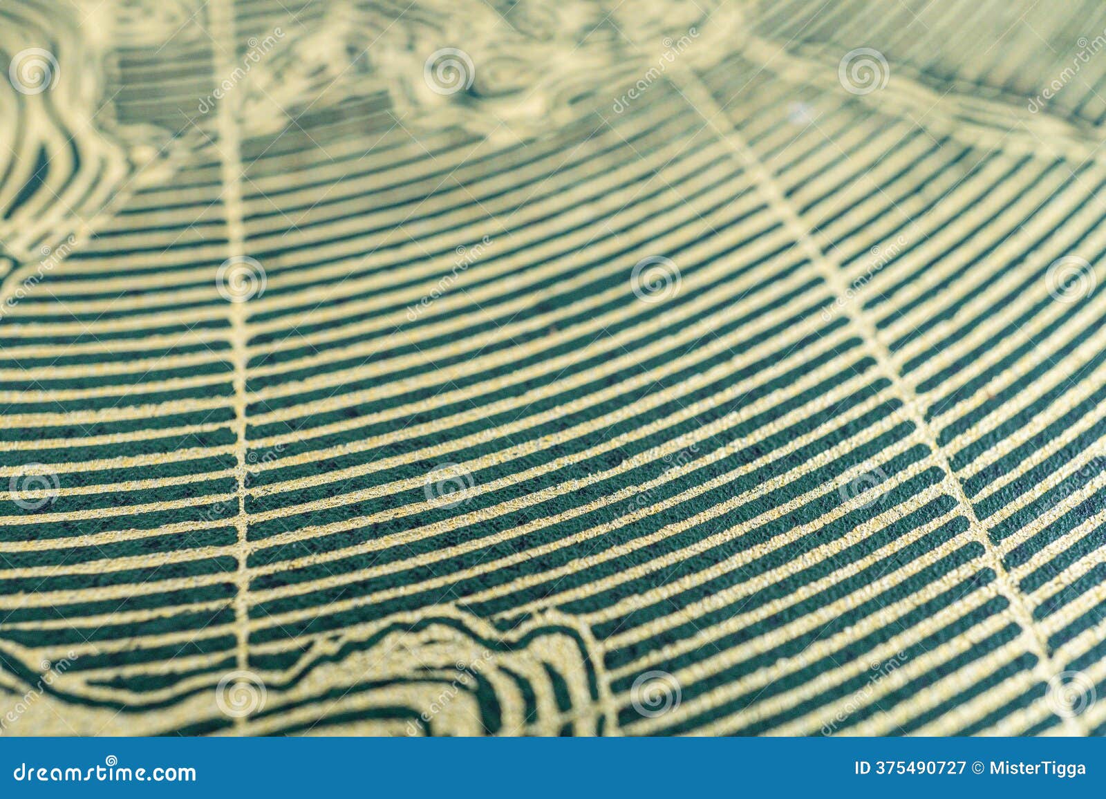 Microscopic Image Showing Chronic Myeloid Leukaemia (CML) Is A Type Of ...