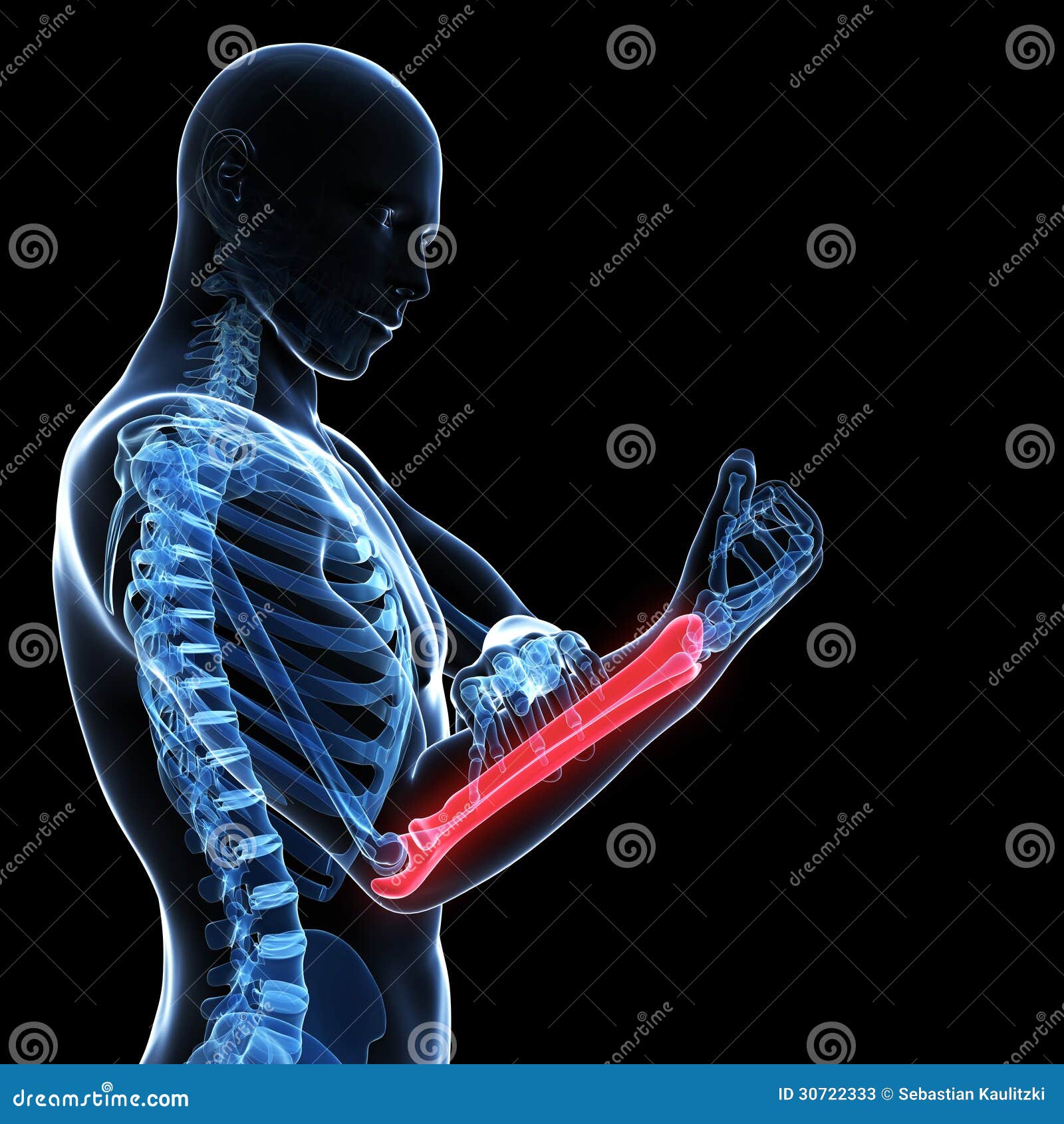 Highlighted arm stock illustration. Illustration of arthritis - 30722333