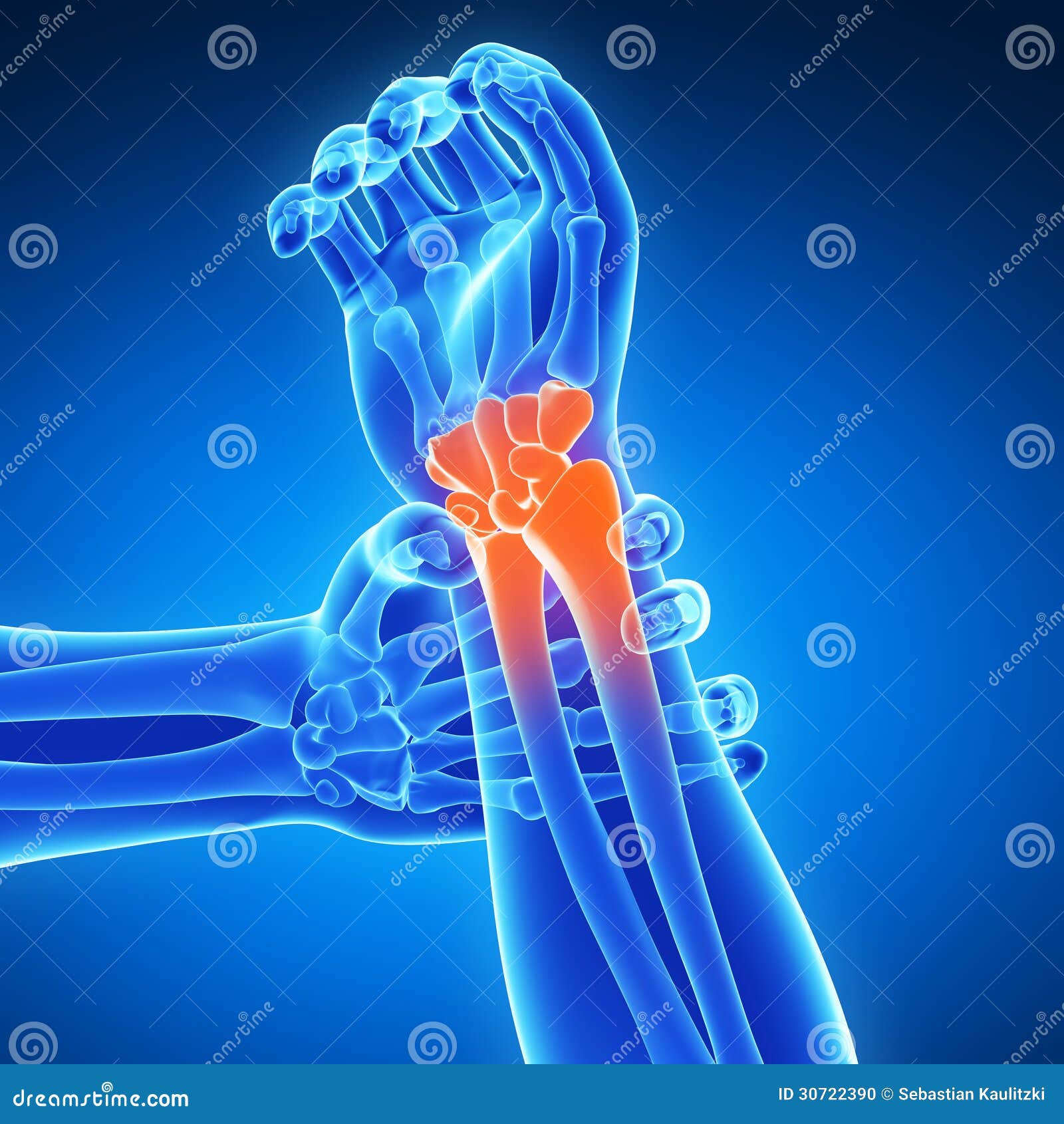 Highlighted Radius Royalty-Free Cartoon | CartoonDealer.com #30723845