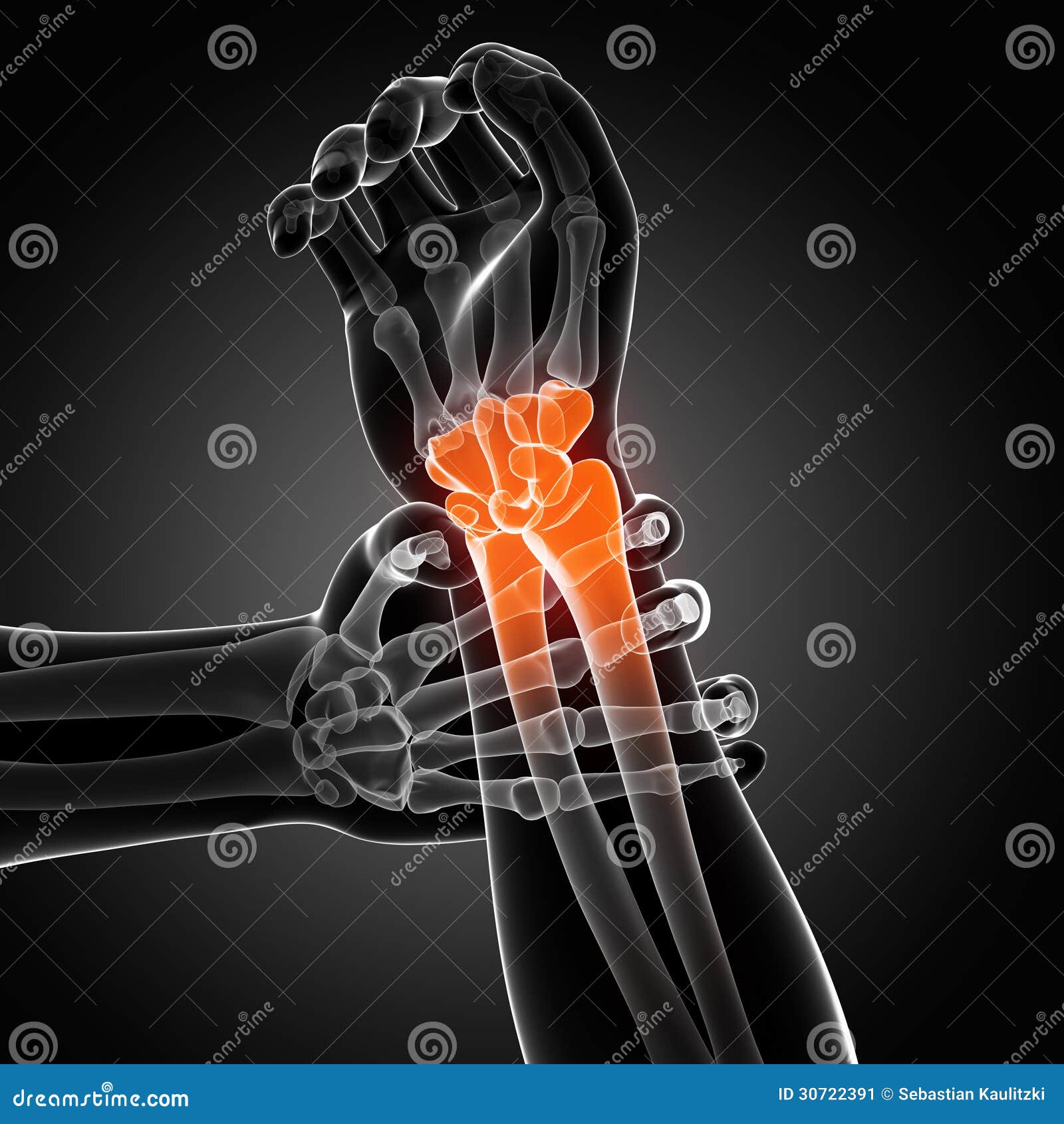 Highlighted arm stock illustration. Illustration of physical - 30722391