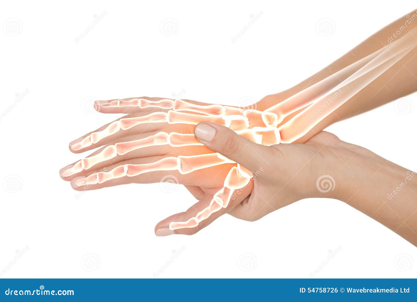 Highlighted Bones of Woman with Hand Pain Stock Photo - Image of ...