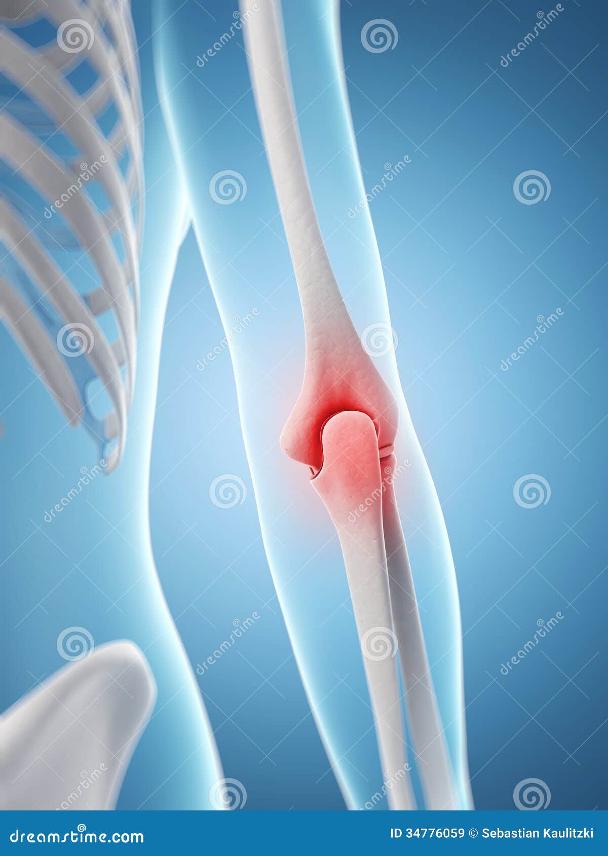 Highlighted elbow joint stock illustration. Illustration of medical ...