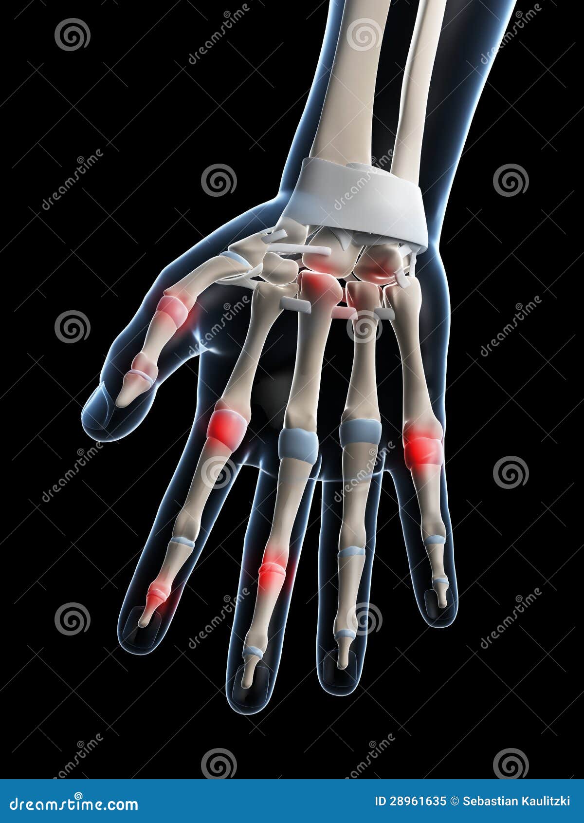 Highlighted Metatarsal Bones Stock Illustration | CartoonDealer.com ...