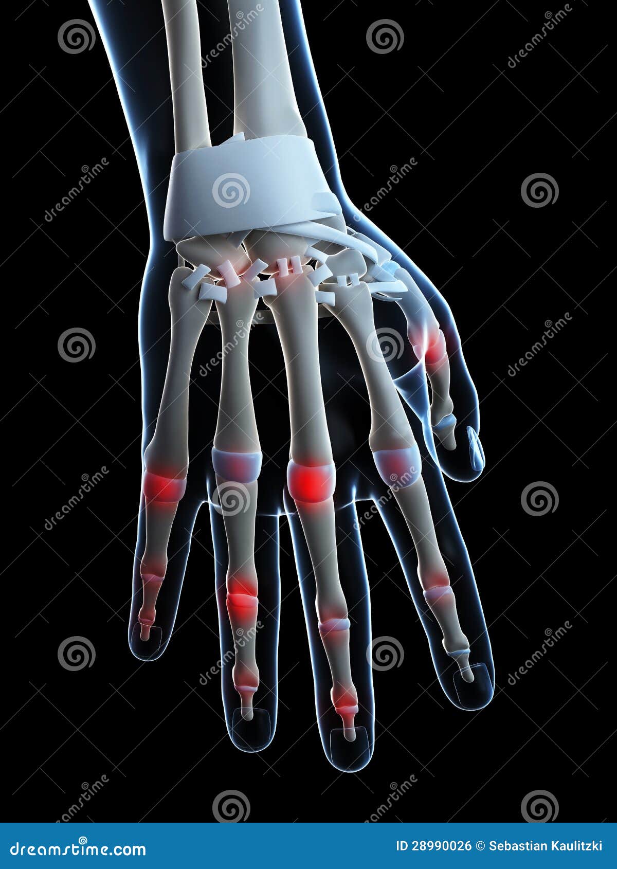 Highlighted finger joints stock illustration. Illustration of anatomy ...