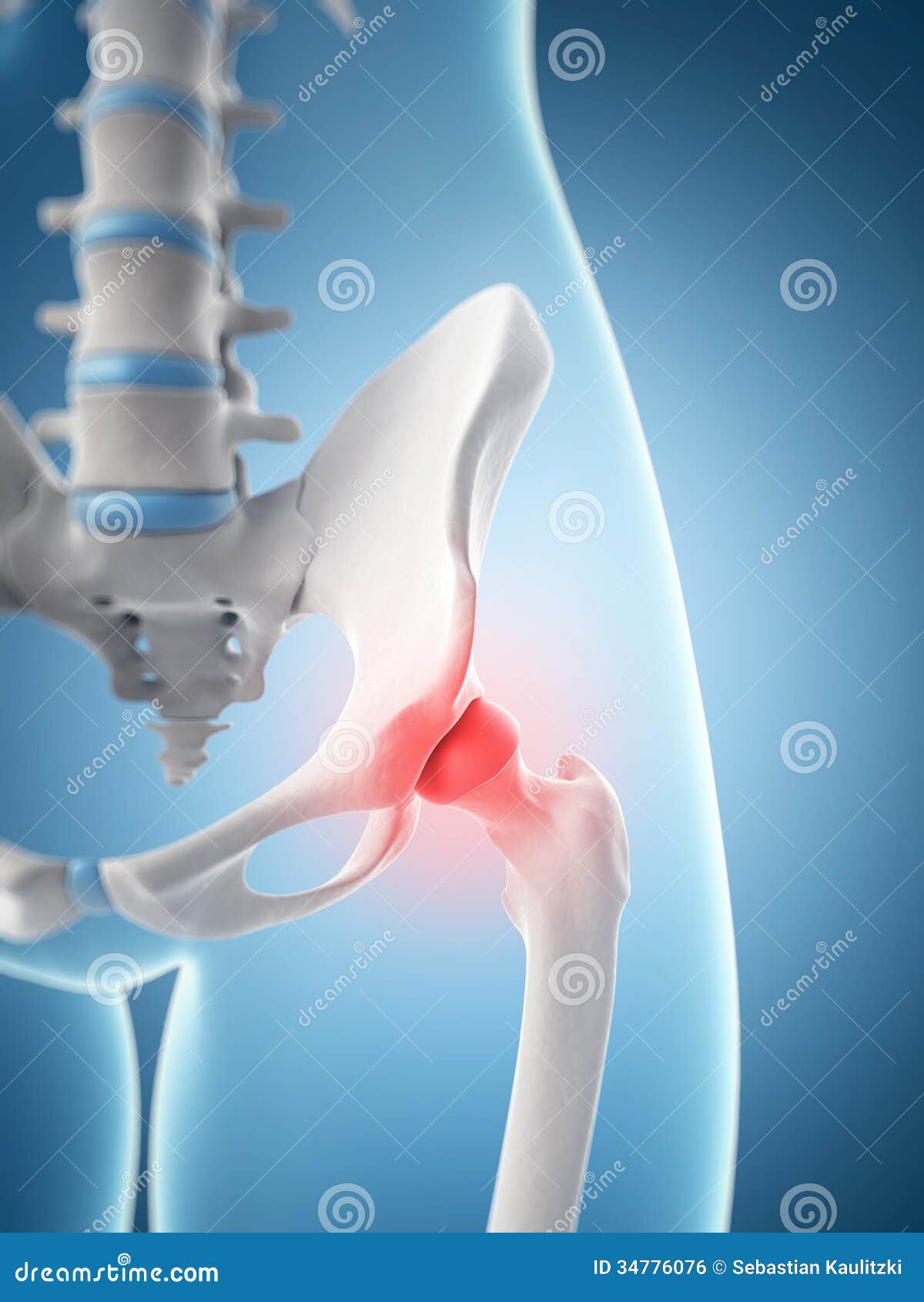 Highlighted hip joint stock illustration. Illustration of structure ...