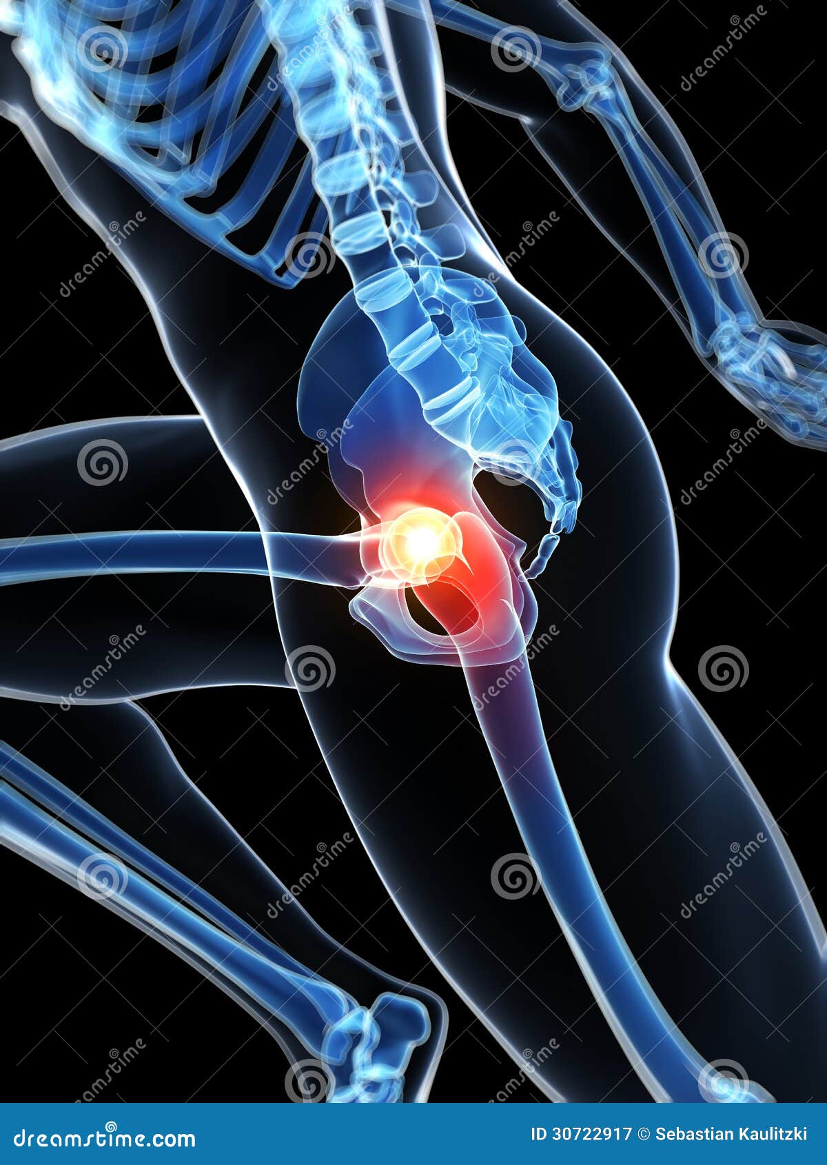 Highlighted hip joint stock illustration. Illustration of joint - 30722917