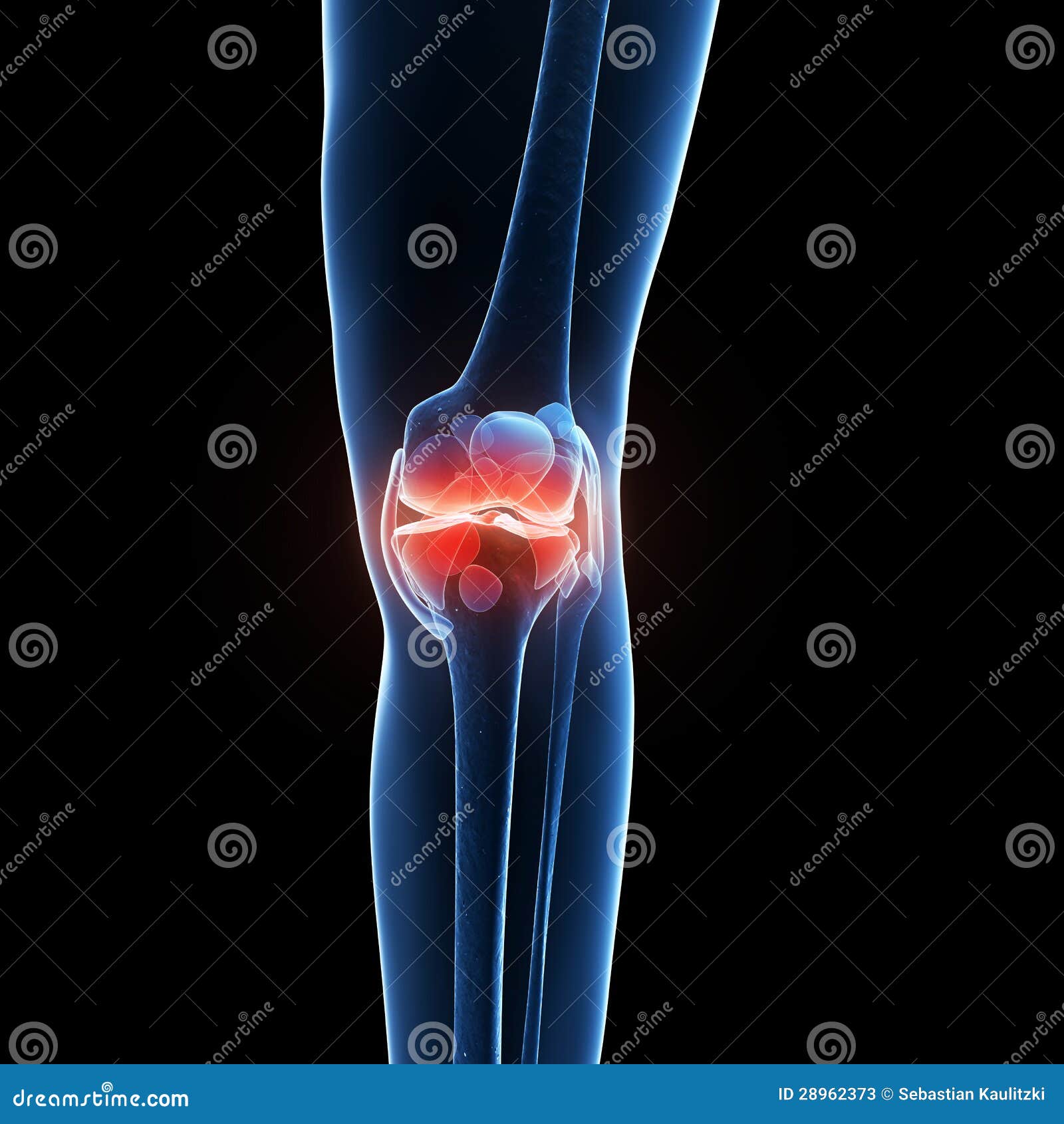 Highlighted human knee stock illustration. Illustration of meniscus ...