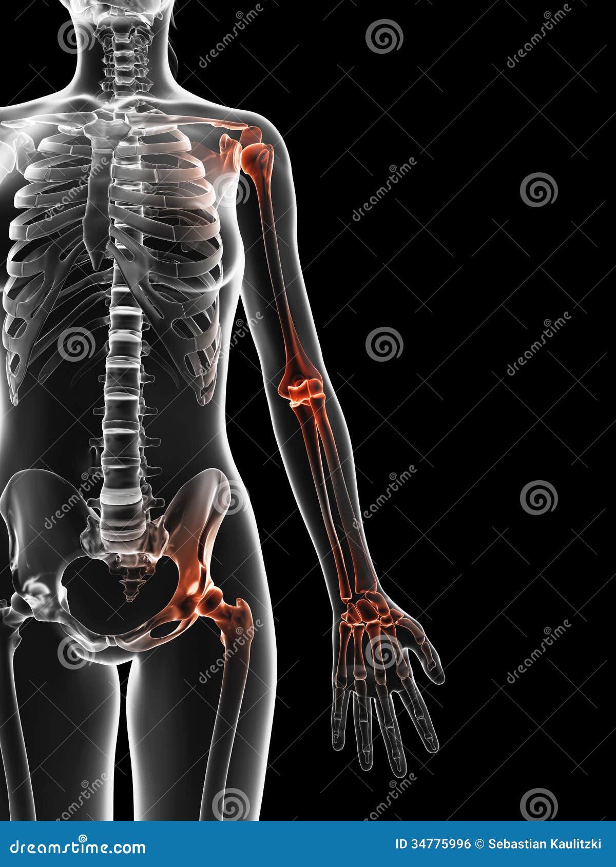 Highlighted joint stock illustration. Illustration of bursitis - 34775996